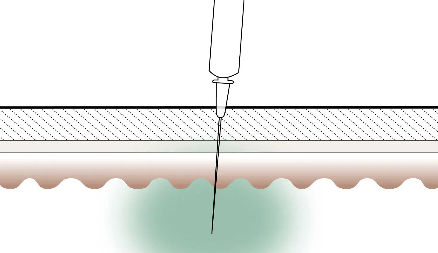 Expert-led Dermal Fillers in NY & DC | Ever/Body
